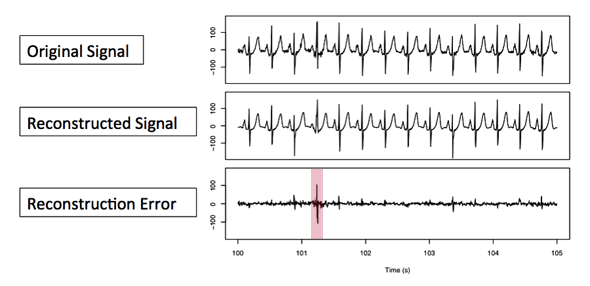 Anomaly Detection in ECG Data